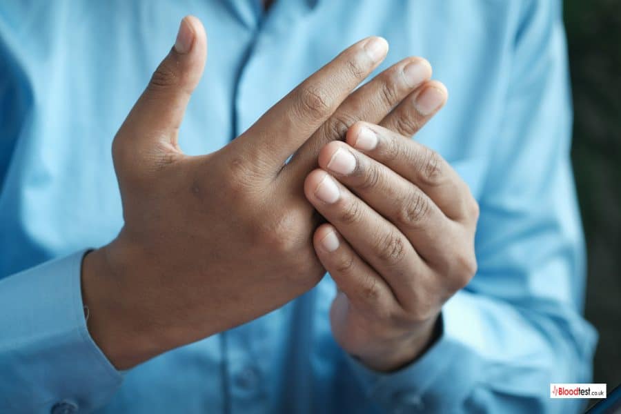 Arthritis Blood Test Markers: A Comprehensive Guide